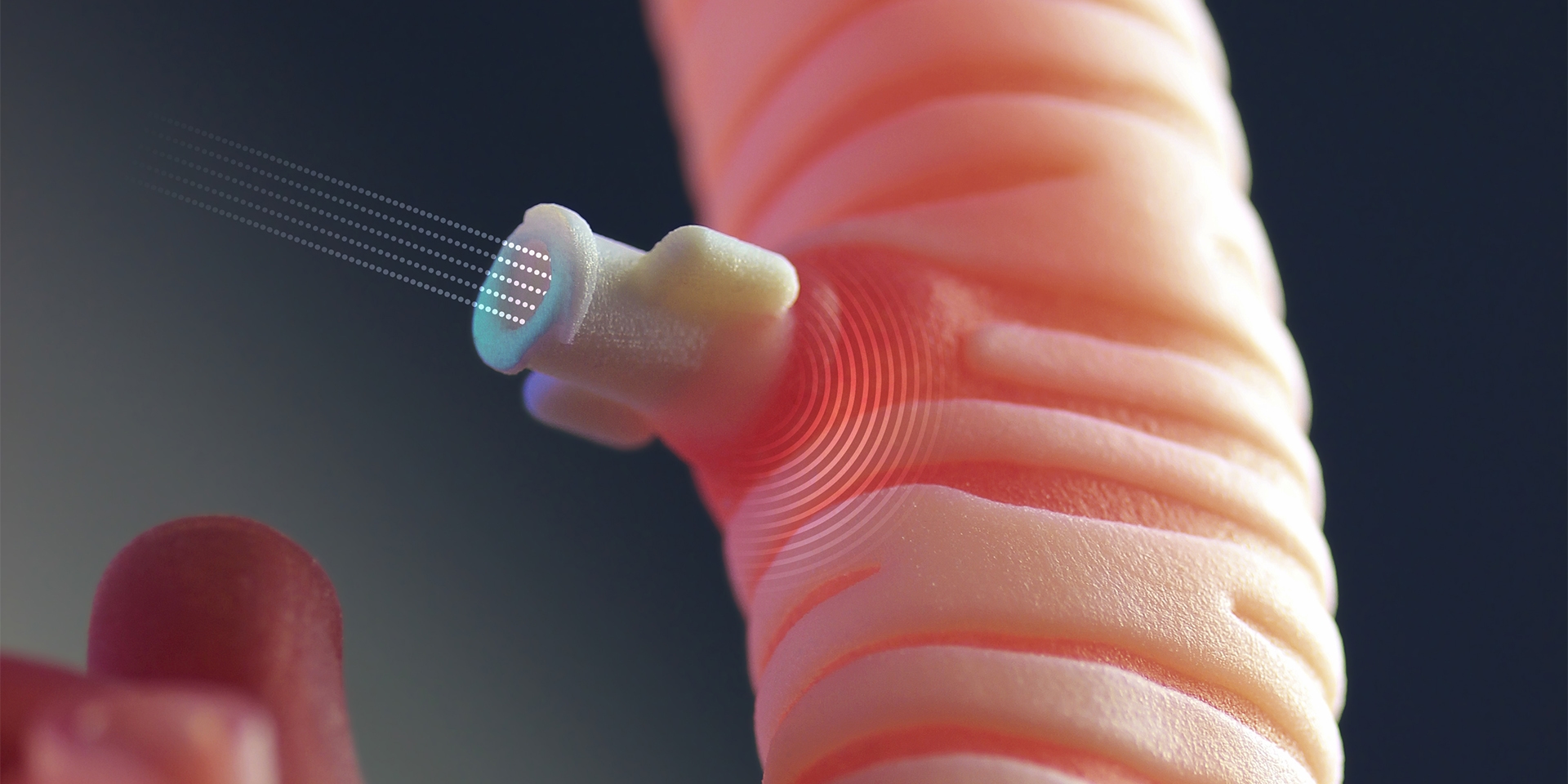 Simpath - 3D Printed Medical Simulation